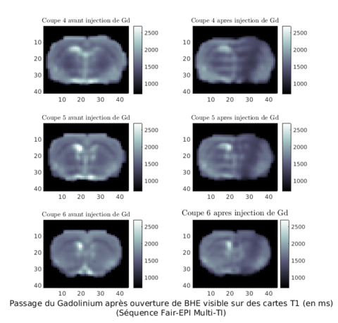 Imagerie par résonance magnétique (IRM) - CREFRE INSERM